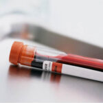 Tampa Diabetes Panel Test - 24/7 Labs