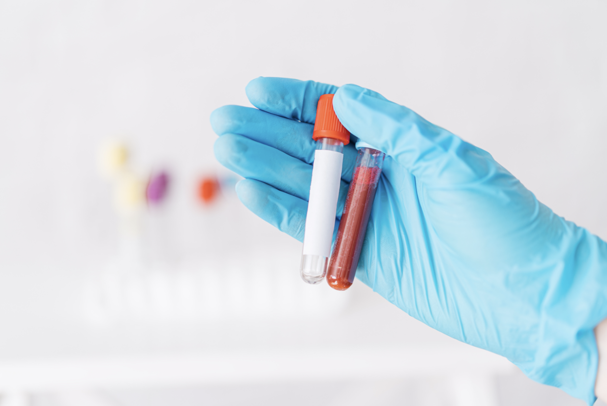 24-7 Labs – From Sample Collection to Test Analysis
