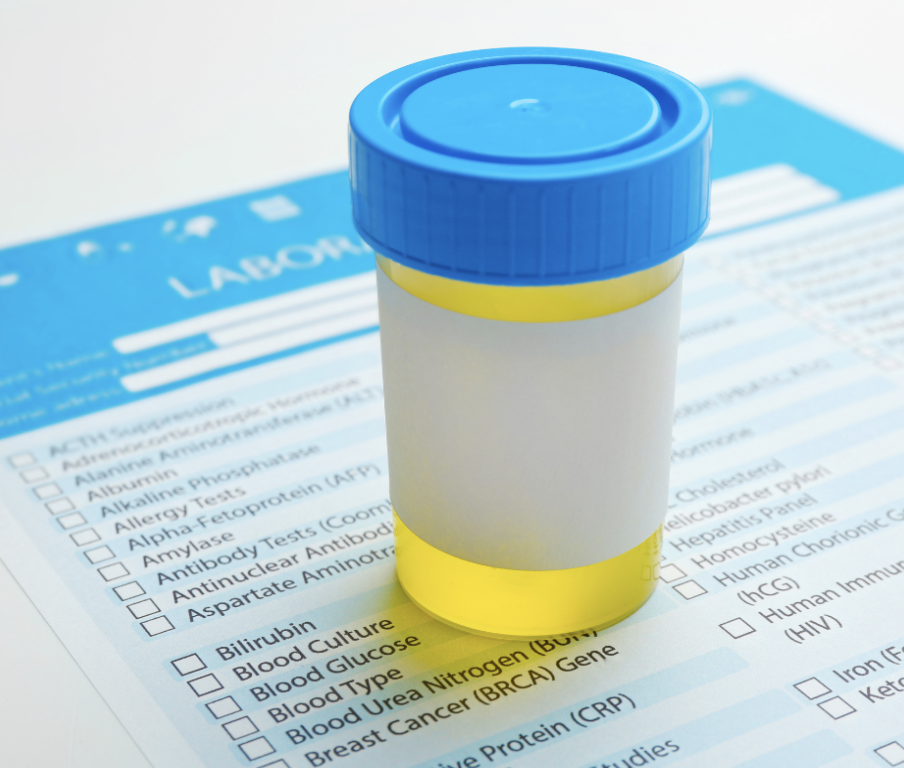 STD Testing – New Habits for a Healthier 2024